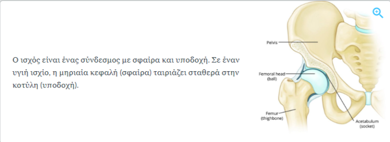 Παροδική οστεοπόρωση του ισχίου
